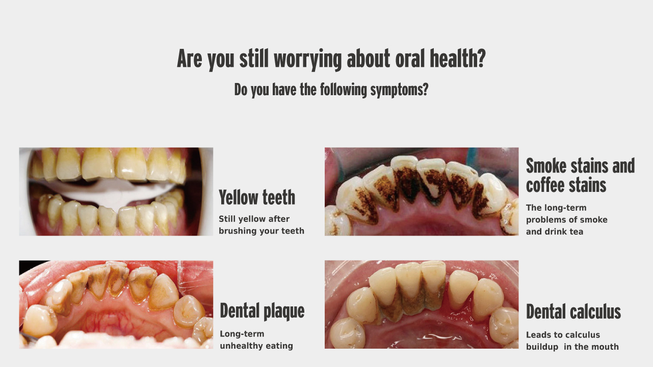 ION SONIC Tooth Cleaner | Maxcare