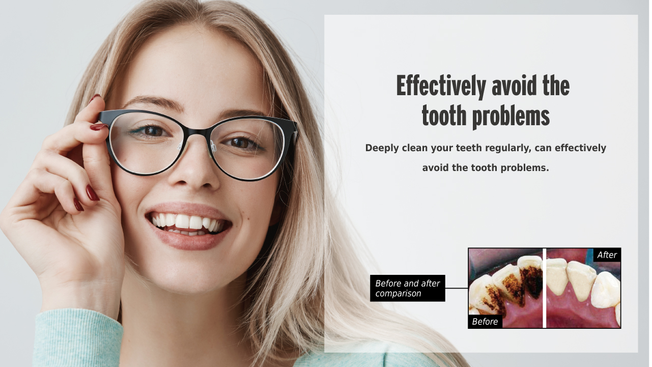 ION SONIC Tooth Cleaner | Maxcare